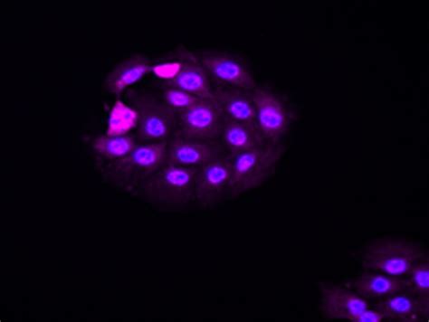 Moc2 Mouse Oral Squamous Cell Carcinoma Oscc Cell Line Scc470