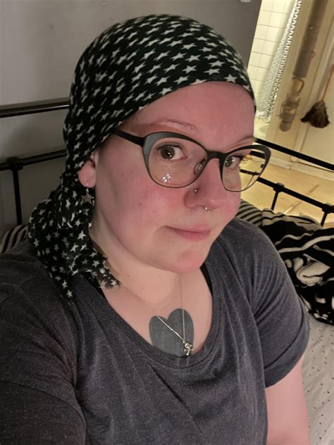 Going Bald As A Woman Rbald