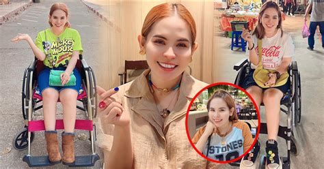 អង្គុយលើរទេះរុញមែន ពៅ បញ្ញាពេជ្រ នៅតែញញឹមស្រស់ស្អាត បញ្ជាក់ភាពរឹងមាំ