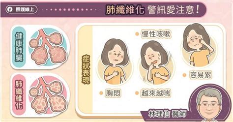 疲累、咳嗽…類風濕性關節炎恐肺纖維化！秒懂圖解懶人包 華人健康網 專業即時優質的健康新聞及資訊分享平台業即時優質的健康新聞及資訊分享平台