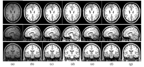 The Segmentation Results For Mr Images With Intensity Inhomogeneity