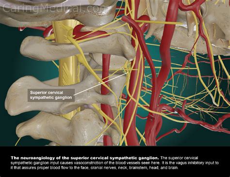 Vagus Nerve Palsy Ppt