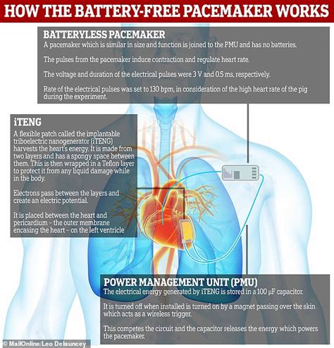 Pacemaker That Uses The Heart To Generate Its Own Electricity And Doesn