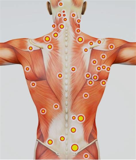 [동래pt]근막통증증후군 제대로 알려주는 멋짐 동래점 네이버 블로그