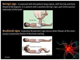 Meningitis Pptx