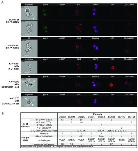 Ctcs And Ctc Normal Cell Clusters In Breast Cancer Detected Using