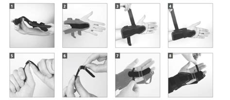 Semi Rigid Wrist Support With Palmar Dorsal Splints 4th 5th Metacarpals Manutec Orliman E