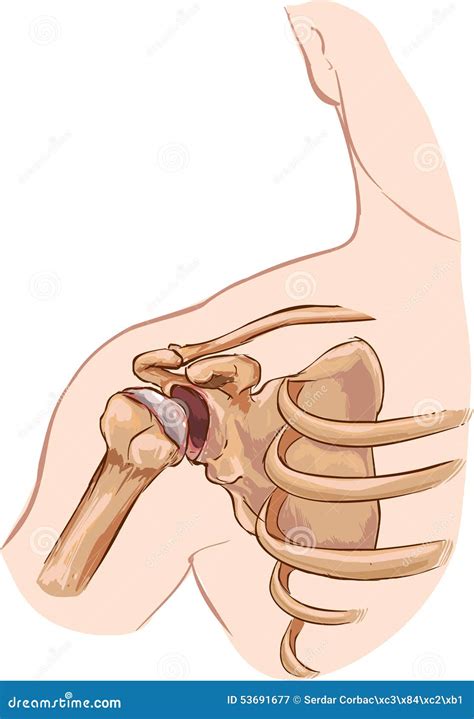 Shoulder Dislocation Stock Vector Illustration Of Medical 53691677