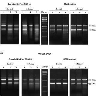 Electropherogram Summary Of Agilent 2100 Bioanalyzer For RNA Samples Of Download Scientific