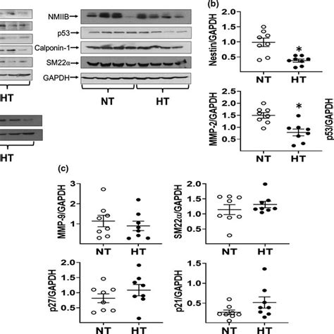 Morphology Of The Ascending Aorta Of Male Normotensive And Hypertensive