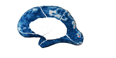 the brain is not properly flattened · issue 419 · gallantlab pycortex