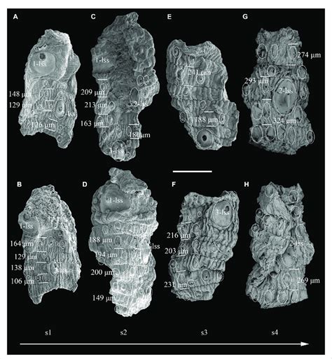 The Possible Developmental Sequence Of Indeterminate Form 3 Sensu Liu