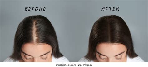 Hair before after 사진 및 이미지 Shutterstock