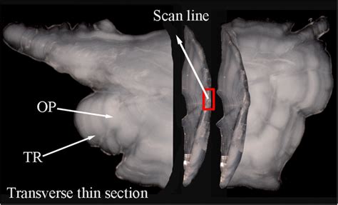Image Of Eulachon Otolith And Position Of A Transverse Thin Section