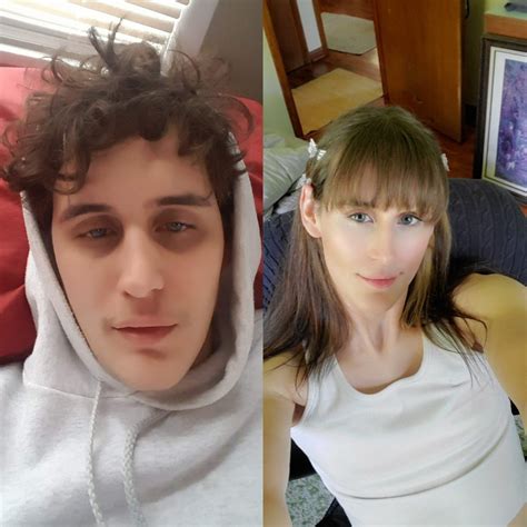 I Was Horribly Addicted To Opiates In The Pic On The Left And Now Im