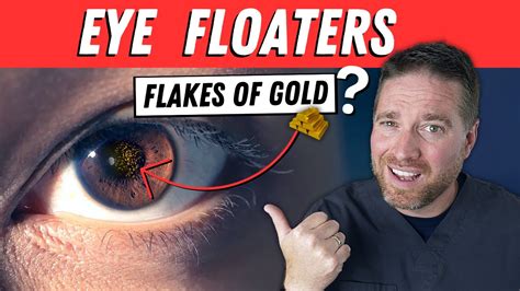 Asteroid Floaters