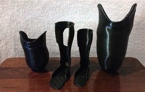 Ks For 3dp Lower Limb Prosthetics 3d Printing Industry