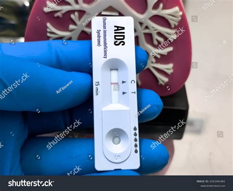 Rapid Test Cassette Aids Acquired Immunodeficiency Stock Photo Shutterstock