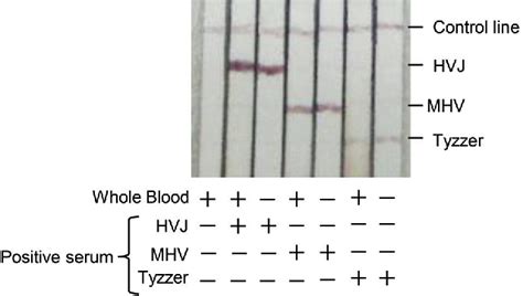Figure 1 From Multiplex Immunochromatographic Assay For Serologic Diagnosis Of Major Infectious