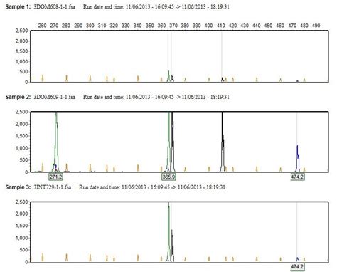 Figure G2 Electropherogram Of Three Participant Samples Showing Dat1