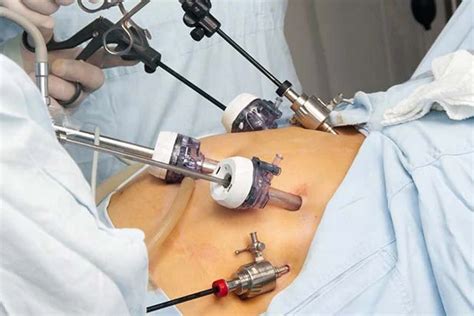 Minimal Invasive Surgery Malvi Hospital