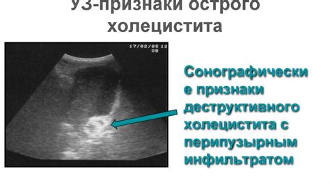 Желчнокаменная болезнь и ее осложнения презентация онлайн