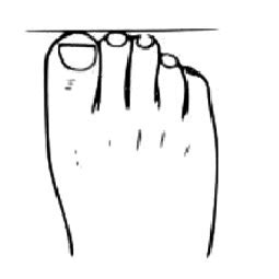Classification Of Feet Download Scientific Diagram