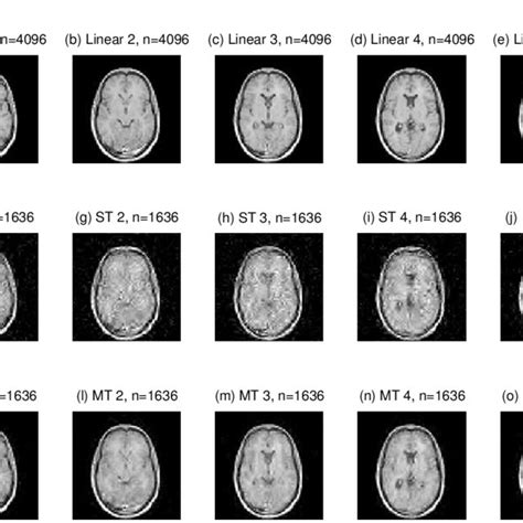 Reconstruction Of Mri Images With Hybrid Cs A E Linear Download Scientific Diagram