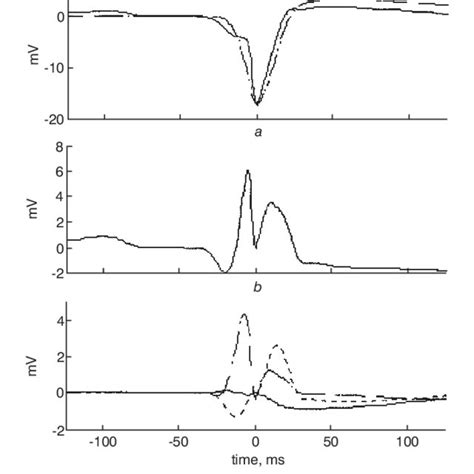 Endocardial Electrograms Exhibiting A Severe Pressureinduced Download Scientific Diagram