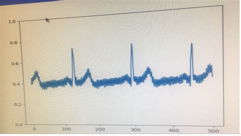 Python Real Time ECG Filtering Stack Overflow
