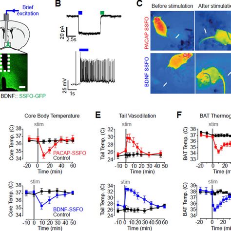 PDF Warm Sensitive Neurons That Control Body Temperature