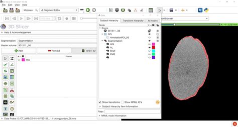 Segment Not Showing Up On The Segment Editor Development 3d Slicer
