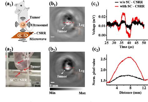 Figure 10 From Split Ring Resonator Topology Based Microwave Induced Thermoacoustic Imaging Srr