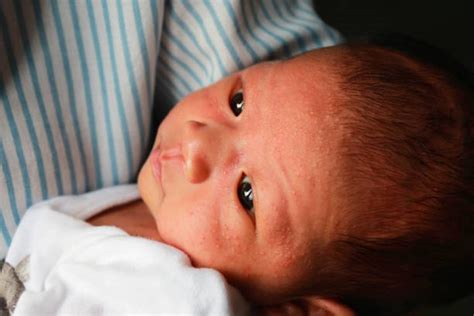 أسباب ظهور حبوب حمراء في وجه الرضيع مجلة سيدتي