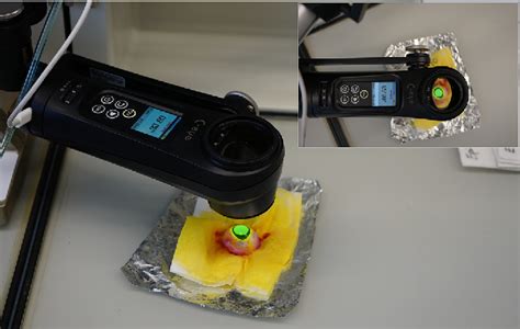 Figure 1 From High Fluence Accelerated Epithelium Off Corneal Cross Linking Protocol Provides