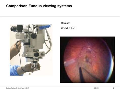 Comparison Resight And Other Fundus Viewing Systems Dr Ajay Dudani Ppt Eye And Vision