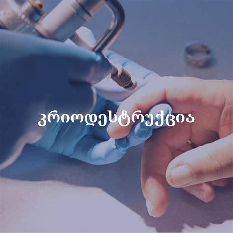 ი ციციშვილის სახელობის ბავშვთა კლინიკა Tbilisi