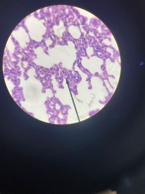 Simple Squamous Popsockets Squamous Simple