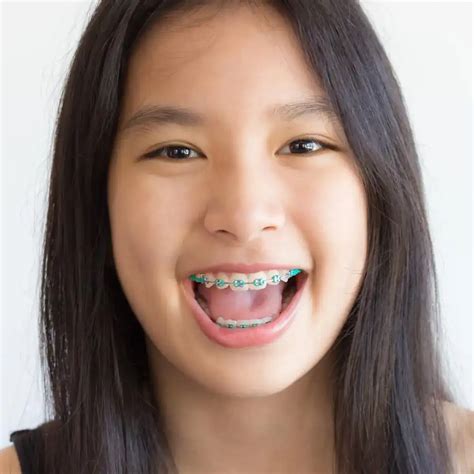 Memakai Behel Dan Rambut Sambung Apakah Harus Dicopot Saat Meninggal Dunia Keuangan News