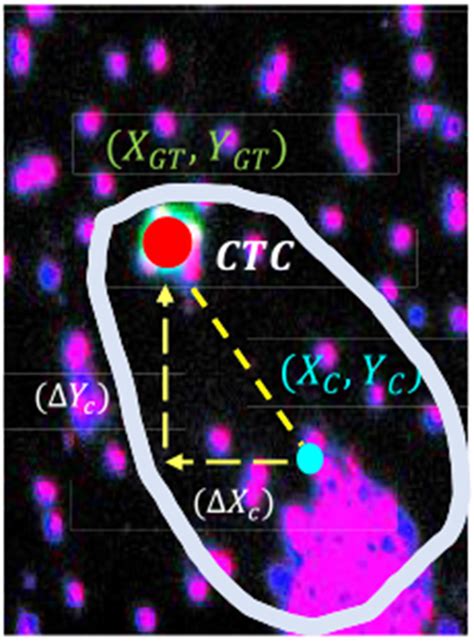 A Hybrid Intelligence Approach For Circulating Tumor Cell Enumeration