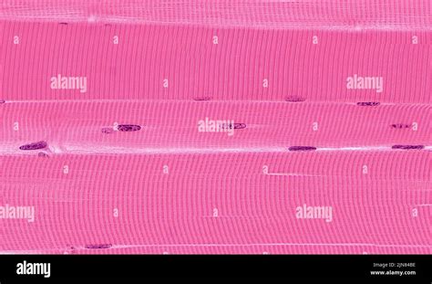 Skeletal Muscle Light Micrograph Stock Photo Alamy