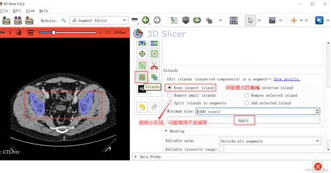 3d Slicer的学习(二) 图像的分割3dslicer窗宽窗位 Csdn博客 3d Slicer的学习(二) 图像的分割3dslicer窗宽窗位 Csdn博客