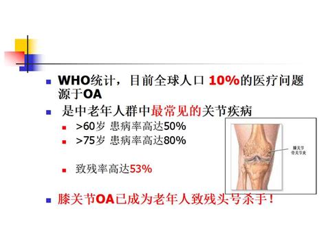 膝骨性关节炎的临床诊治策略 好医术文章 好医术 赋能医生守护生命