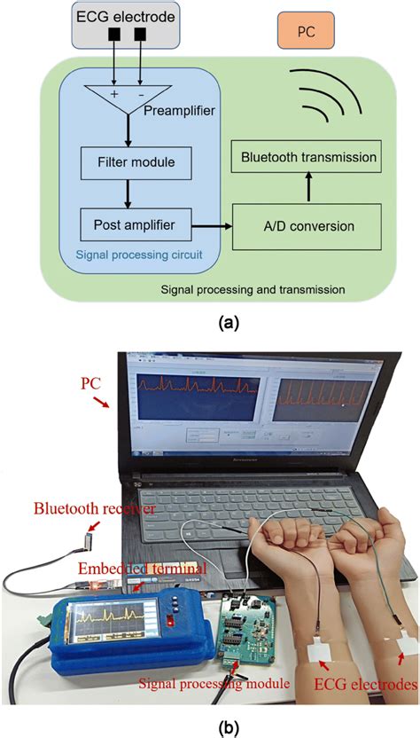 A The Schematic Of Ecg Signal Acquisition Processing And Transmission Download Scientific