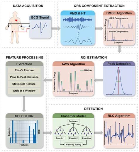 improving r peak detection in ecg signal using dynamic mode selected