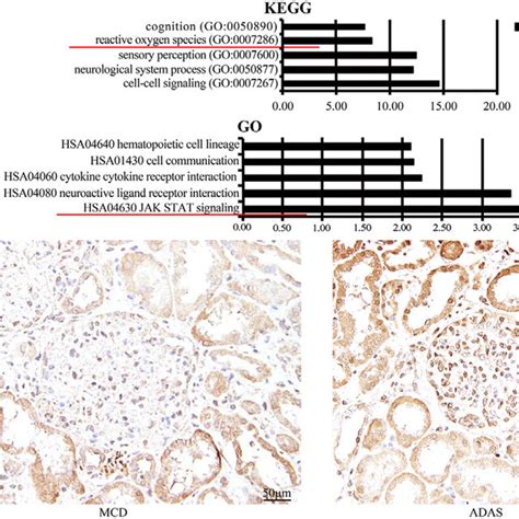 Type Iv Collagen A3 Chain Expression In Glomeruli Of Patients With Adas