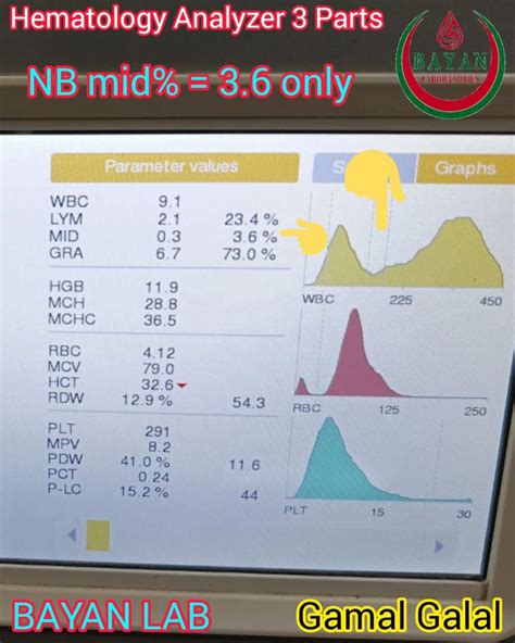 hematology analyzer three parts wrong results and misdiagnoses for