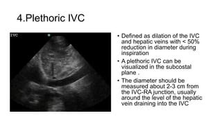 Echocardiography In Cardiac Tamponade Pptx
