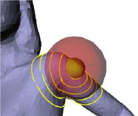 Intersection Between The Input Surface And Spheres Of The Same Radius R Download Scientific