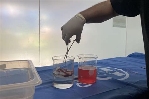 The Times Podcast The Sketchy Test Sending Moms To Prison